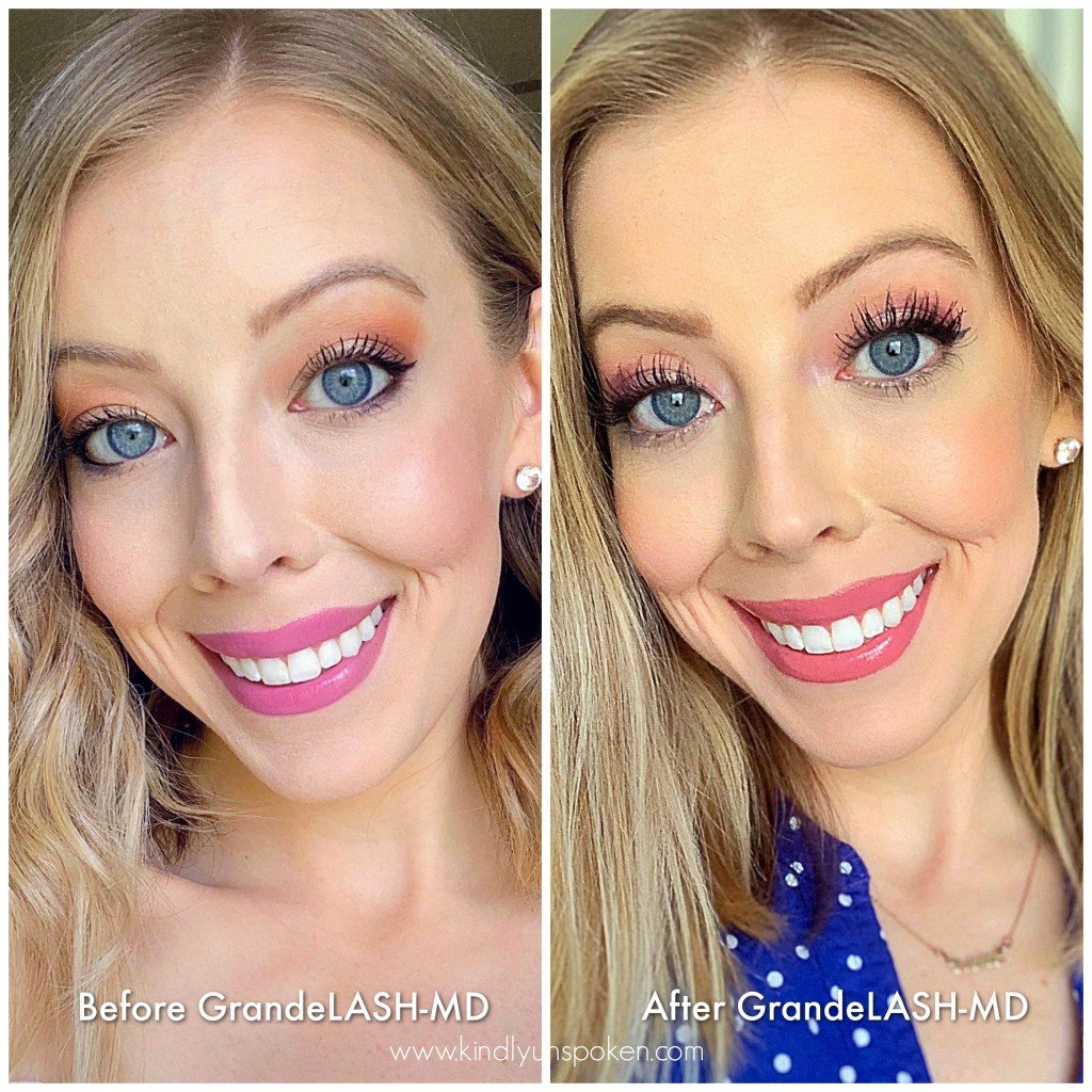 3 Month GrandeLASH-MD Review + Before/After - Kindly Unspoken